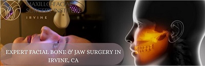 Trusted Oral Care for Facial Bone & Jaw Surgery in Irvine CA